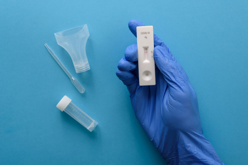 How Do Coronavirus Lab Tests Work? – App Summary